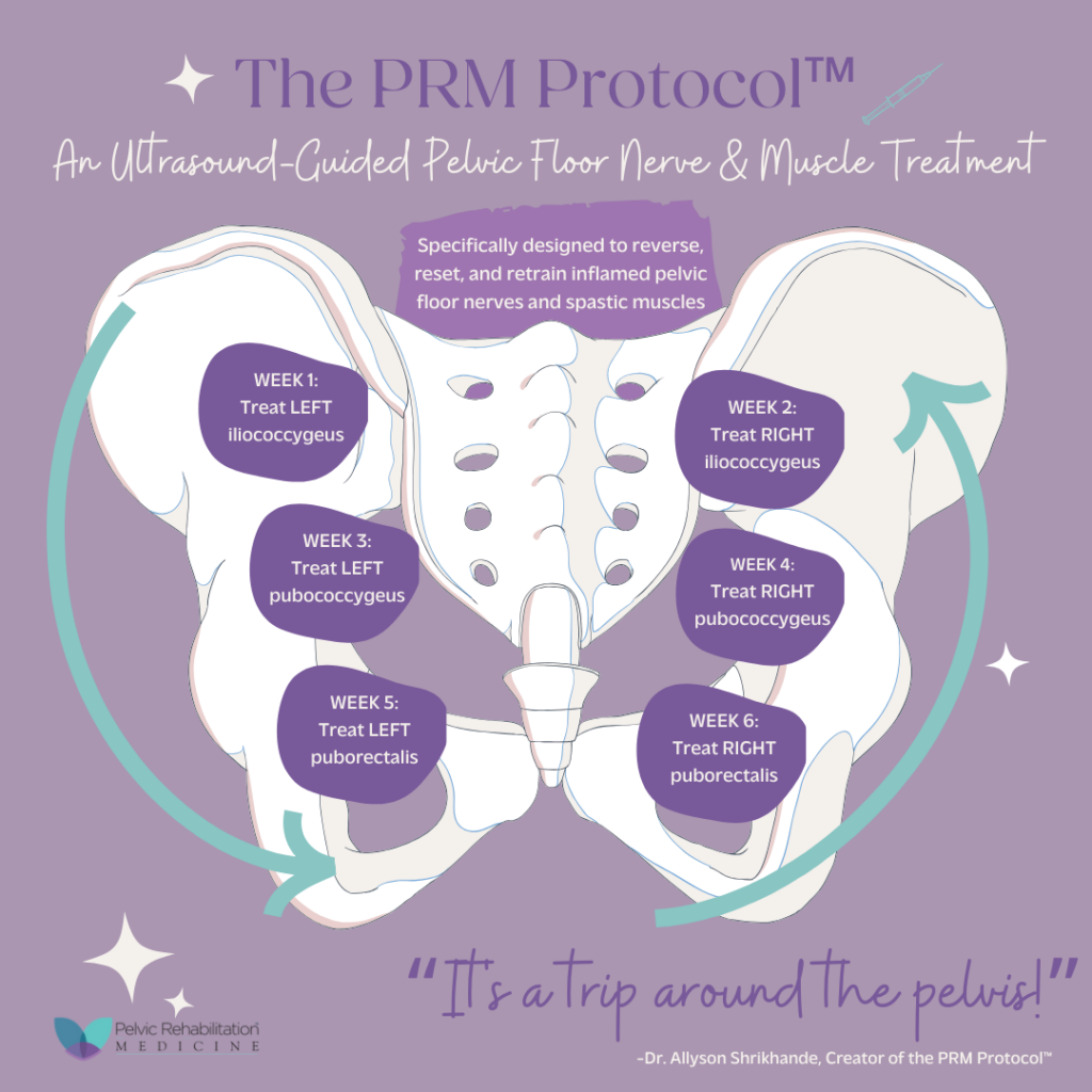 Nerve Block Injections for Endometriosis - Pelvic Rehabilitation Medicine