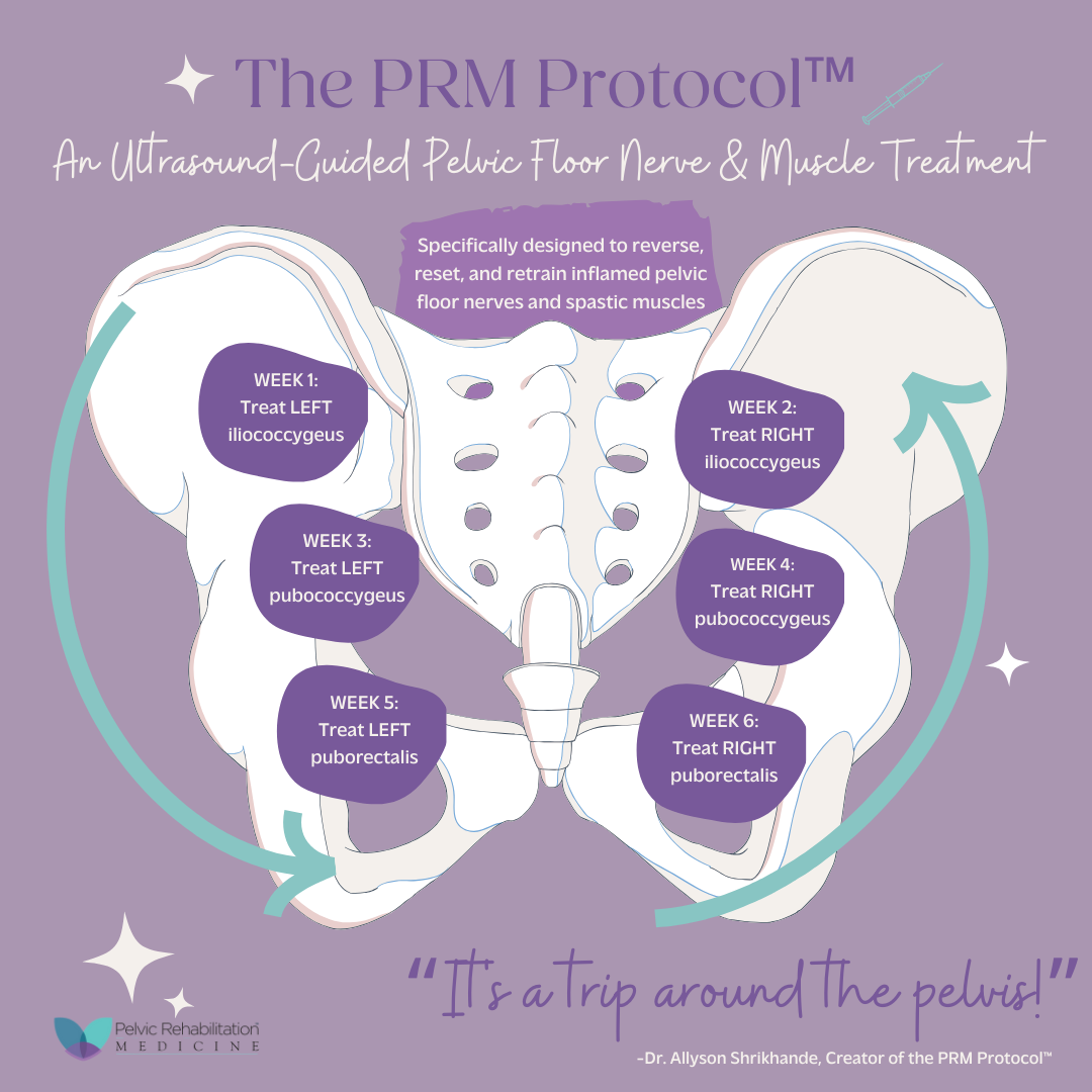 Nerve Block Injections for Endometriosis - Pelvic Rehabilitation Medicine