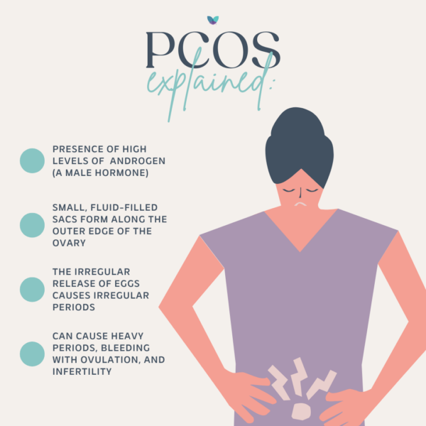 Understanding PCOS: What It Is and How It Can Be Treated - Pelvic ...