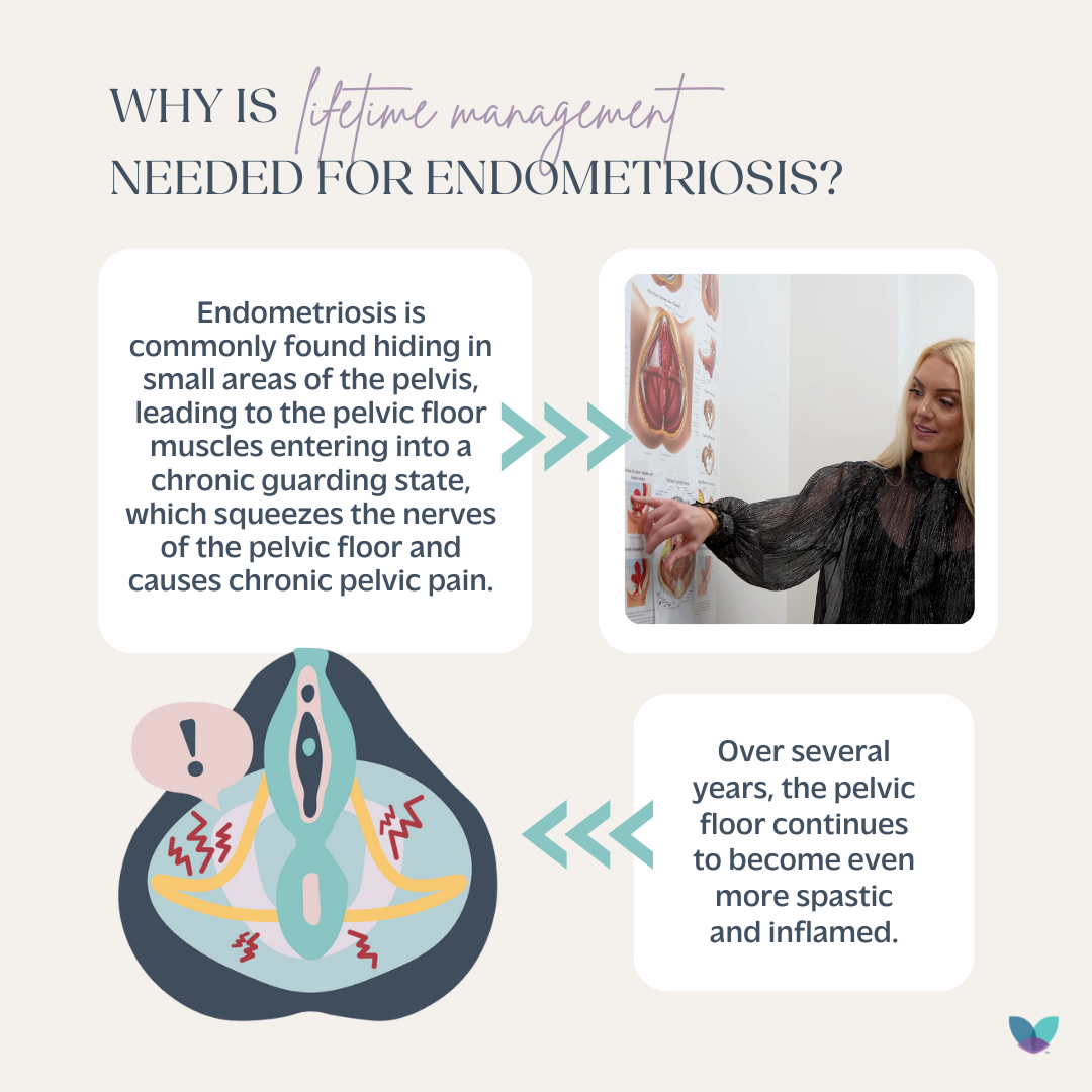 Lifetime Endometriosis Care Expands with PRM Center of Excellence - Pelvic Rehabilitation Medicine