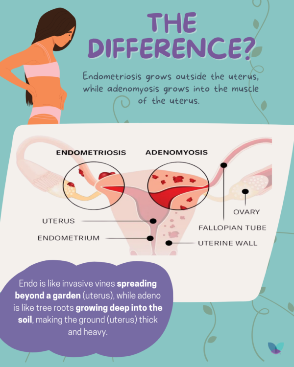 Adenomyosis vs Endometriosis: Understanding the Differences in Symptoms ... Adenomyosis vs Endometriosis: Understanding the Differences in Symptoms ...