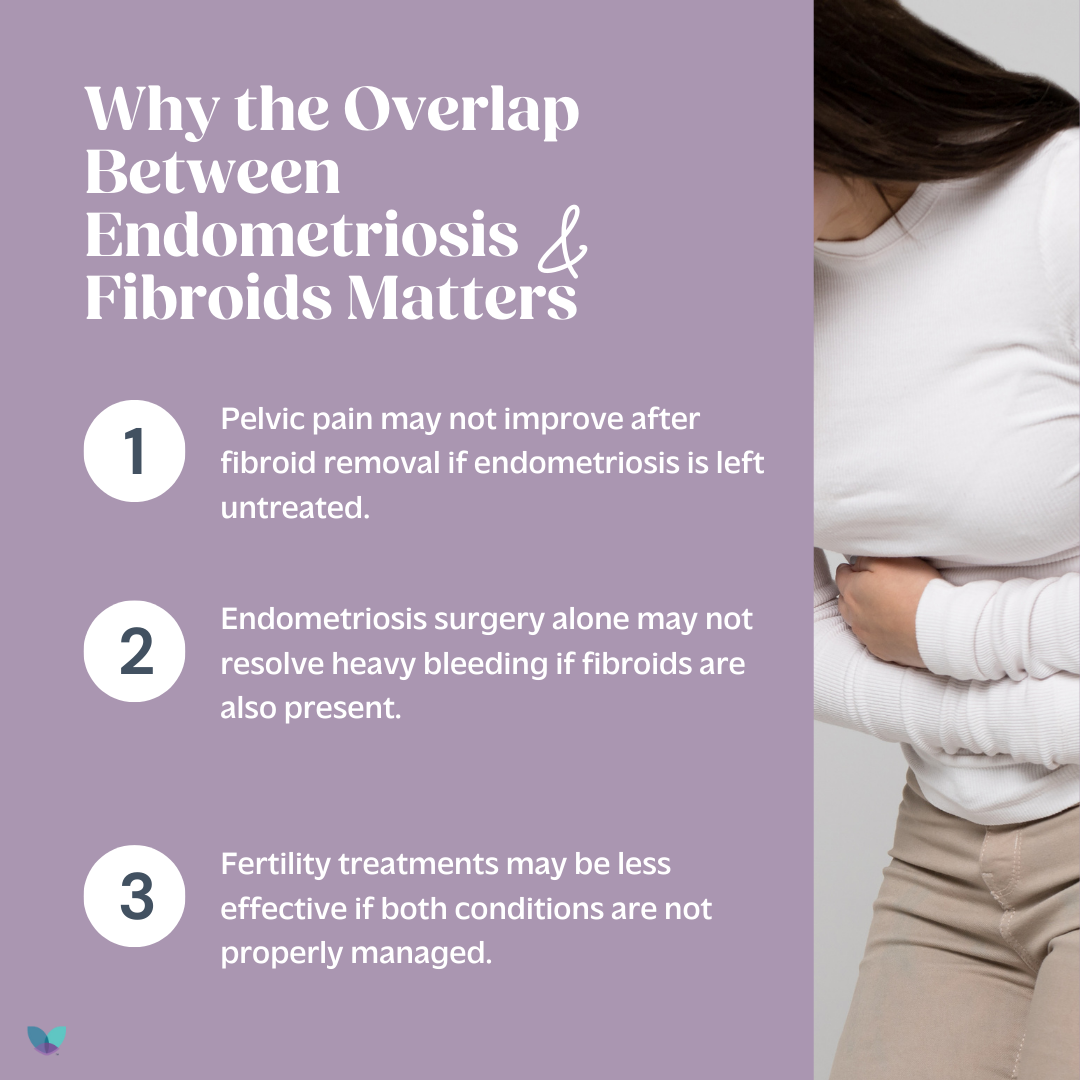 Can I Have Fibroids and Endometriosis? - Pelvic Rehabilitation Medicine