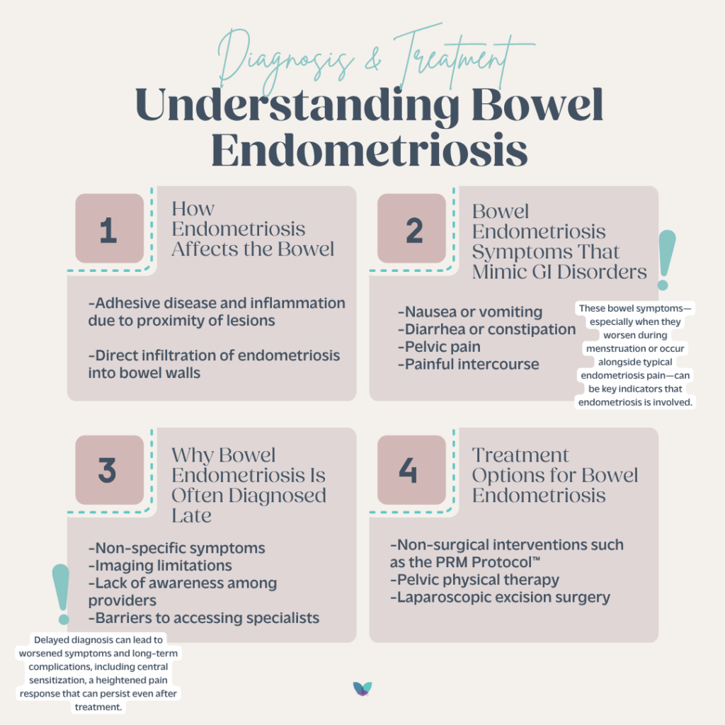 Understanding Bowel Endometriosis: Symptoms, Diagnosis, and Treatment ...
