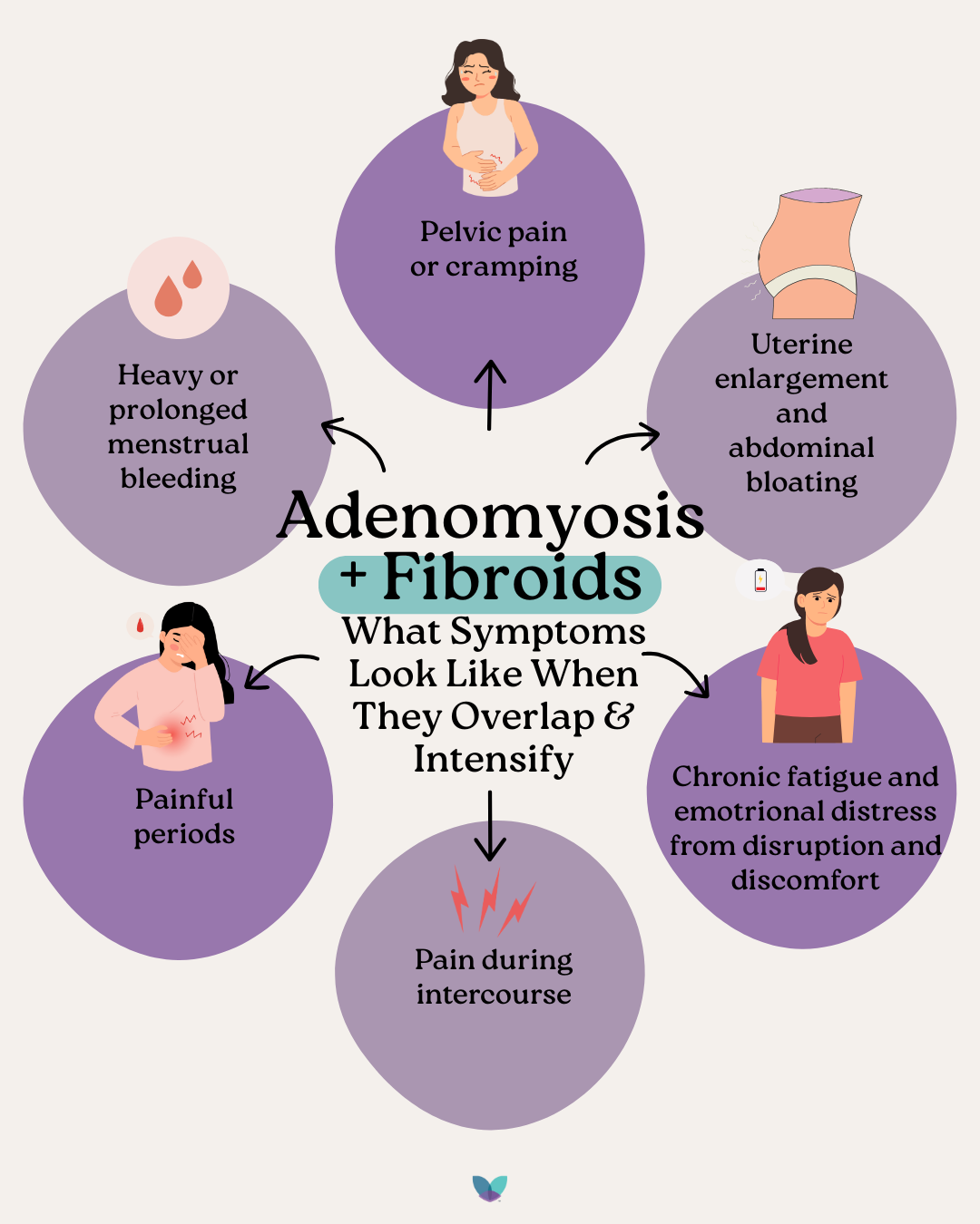 The Overlap of Fibroids and Adenomyosis: What You Need to Know - Pelvic ...